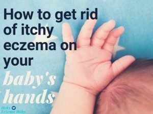 How to Get Rid of Eczema on Hands for Babies | Itchy Eczema Baby